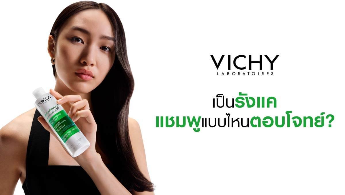 เป็นรังแค เลือกแชมพูแบบไหนถึงตอบโจทย์ ต่อสภาพผิวมากที่สุด