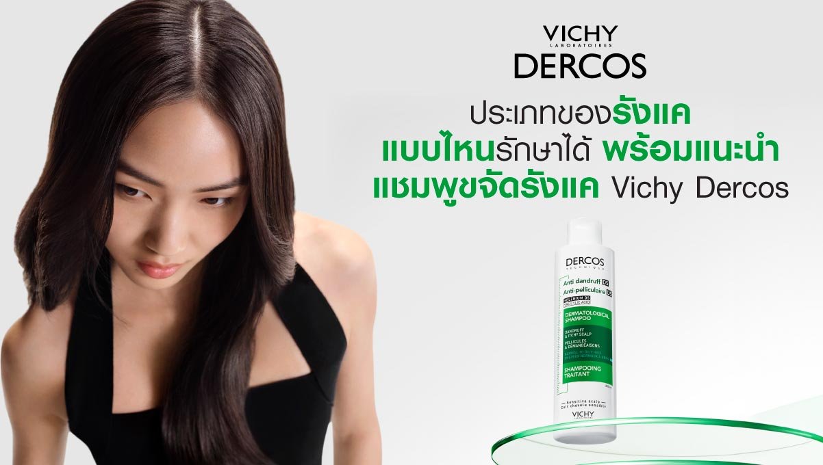 รังแคแบบไหนที่รักษาได้ แนะนำแชมพูขจัดรังแค Vichy Dercos